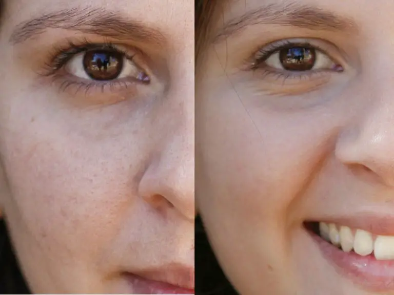 Vitanol A Resenha: Sua pele sem Manchas, Estrias e Rugas